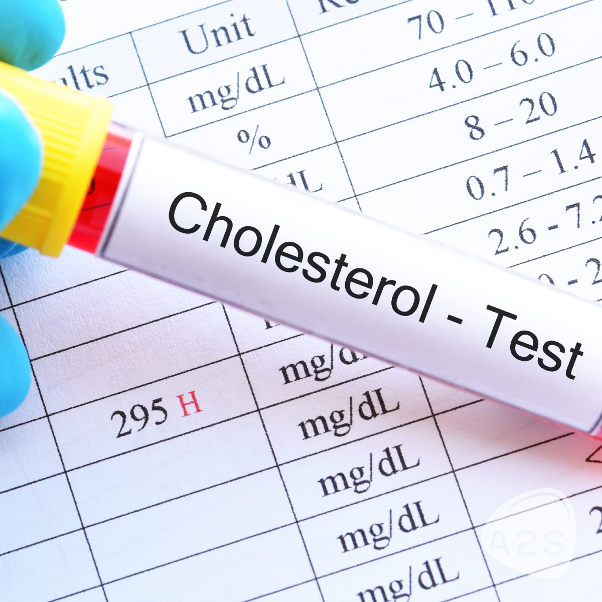 Colesterolo. 2 tipi, tante cose da sapere per aiutarlo